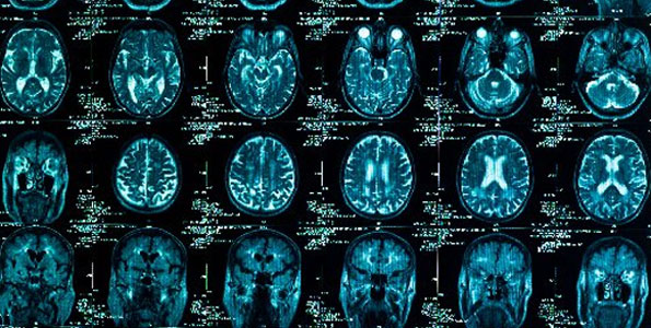 Conjestina’s condition brings back debate on safety of boxing ...