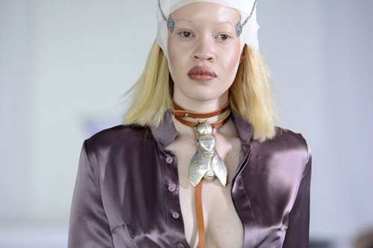 Models with albinism challenge stereotypes - Business Daily