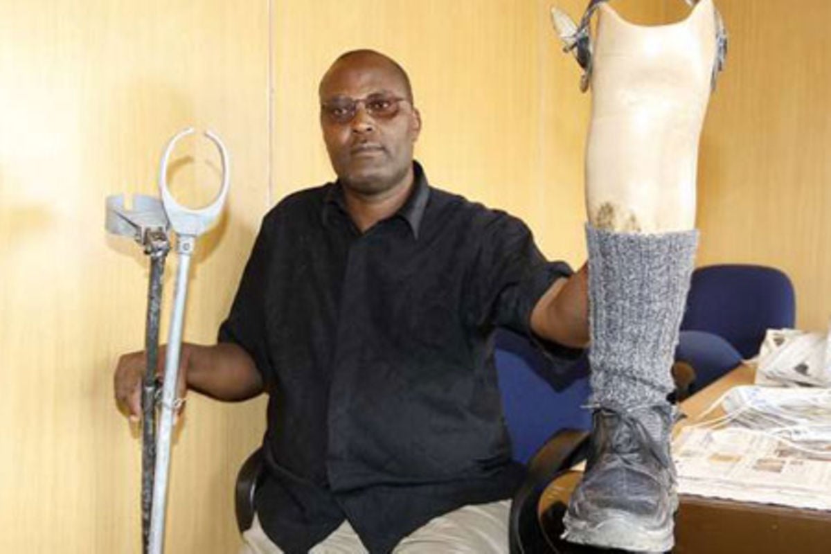 New study findings key to alleviating phantom limb pain after ...