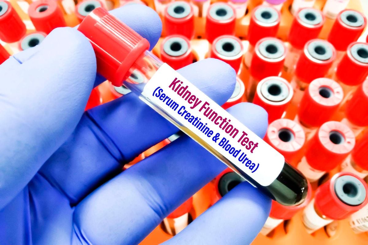 Kenya sets up organ, tissue donation bank - Business Daily